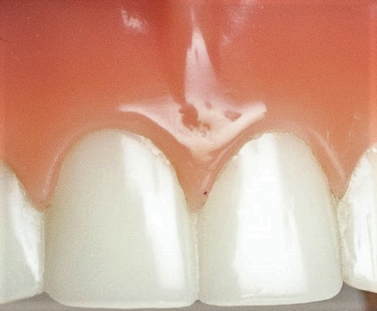 Denvolve Dentist located in Plumstead, Woolwich, London Cosmetic Dental ...